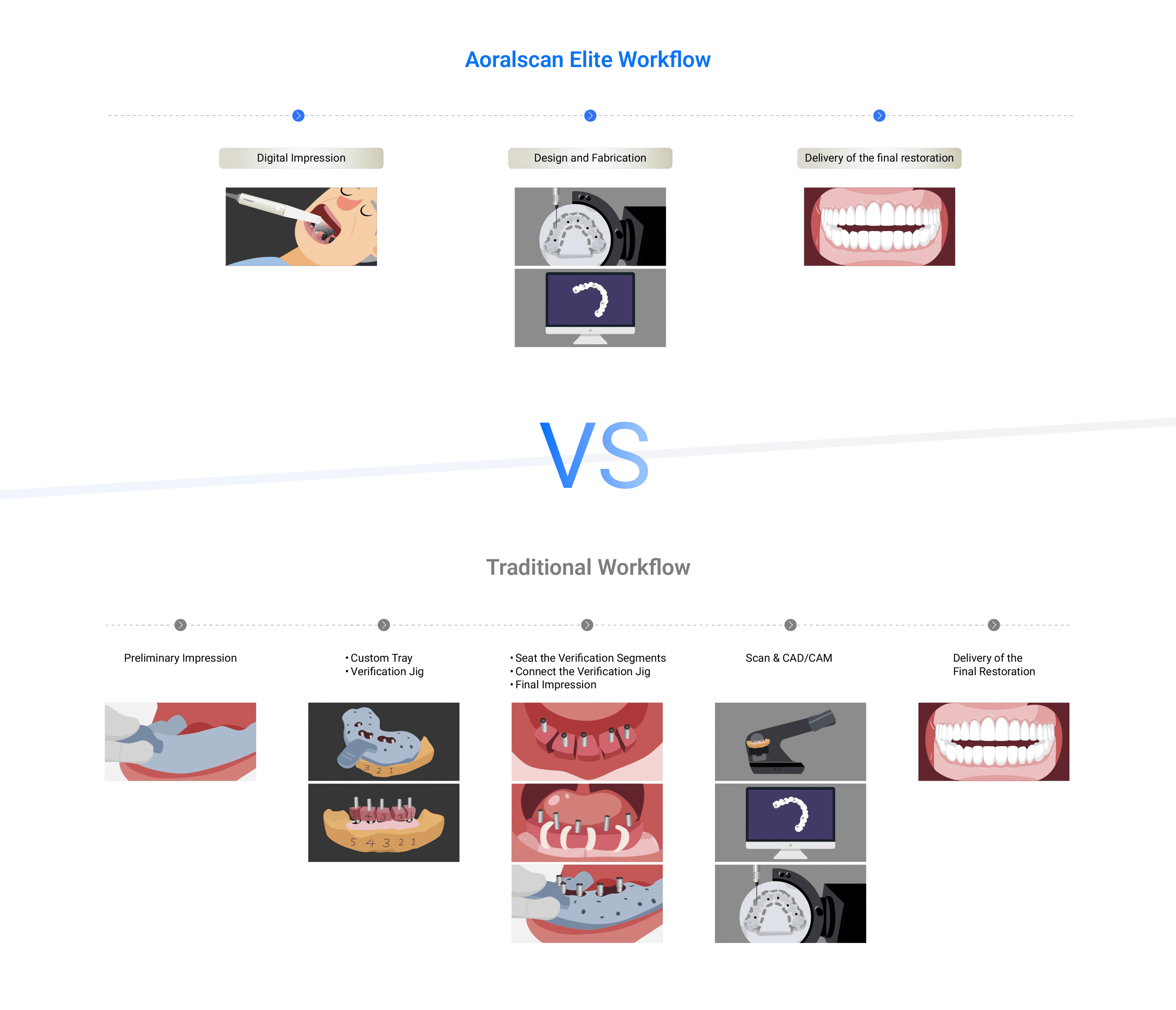 IPG Intraoral Photogrammetry Scanner | Shining 3D Dental