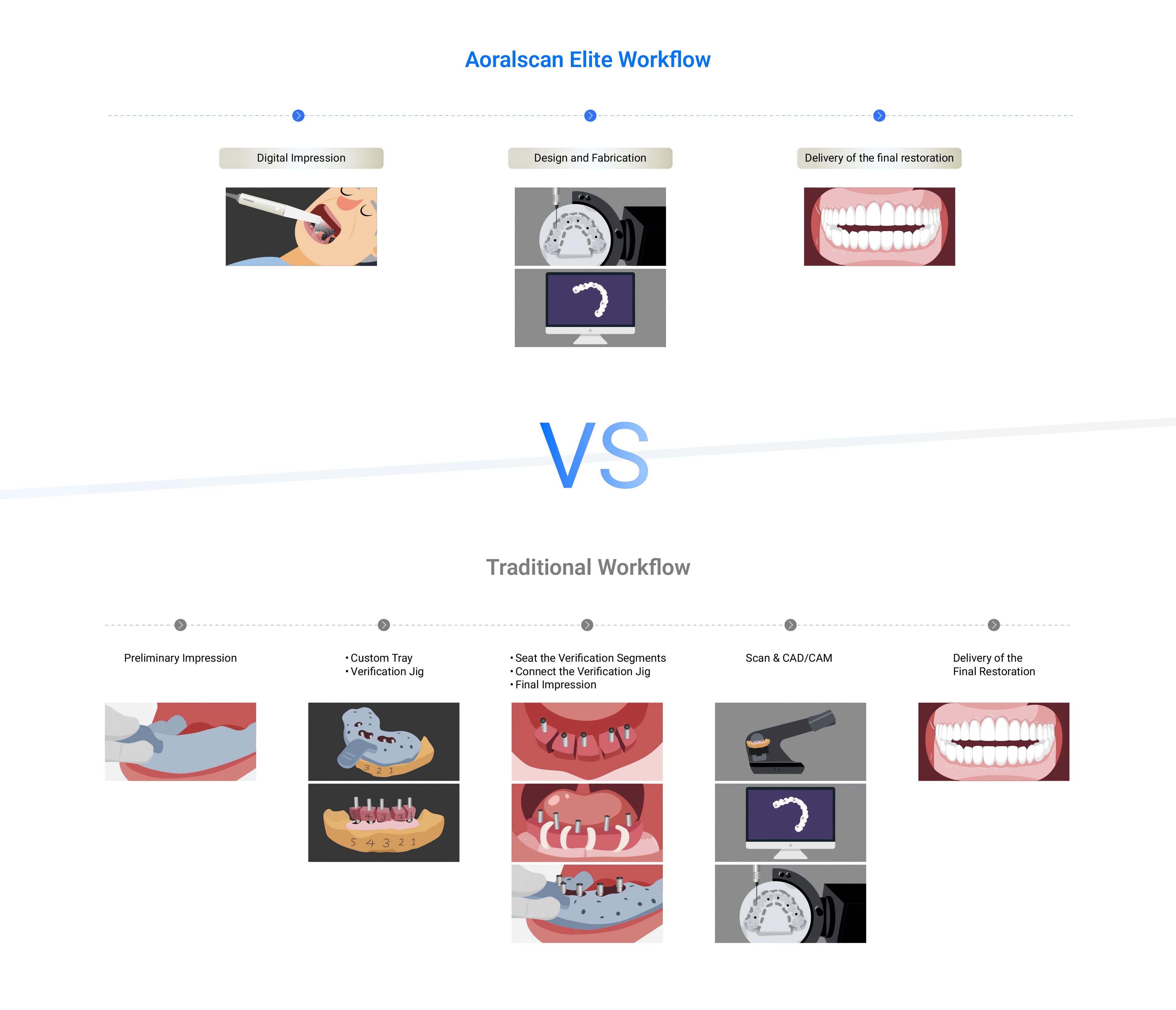 IPG Intraoral Photogrammetry Scanner | Shining 3D Dental