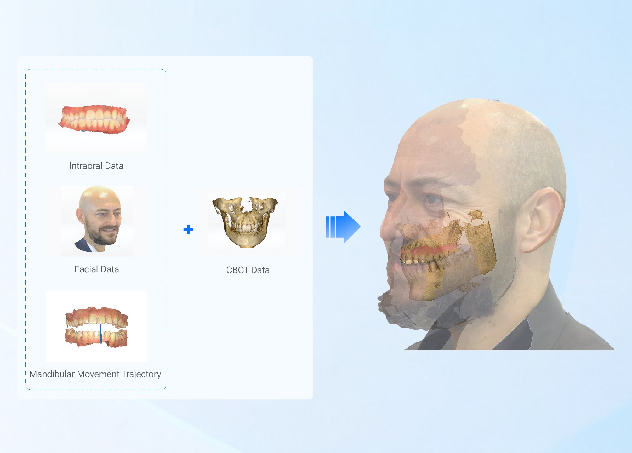 MetiSmile Face Scanner | Digital Smile Design | Shining 3D