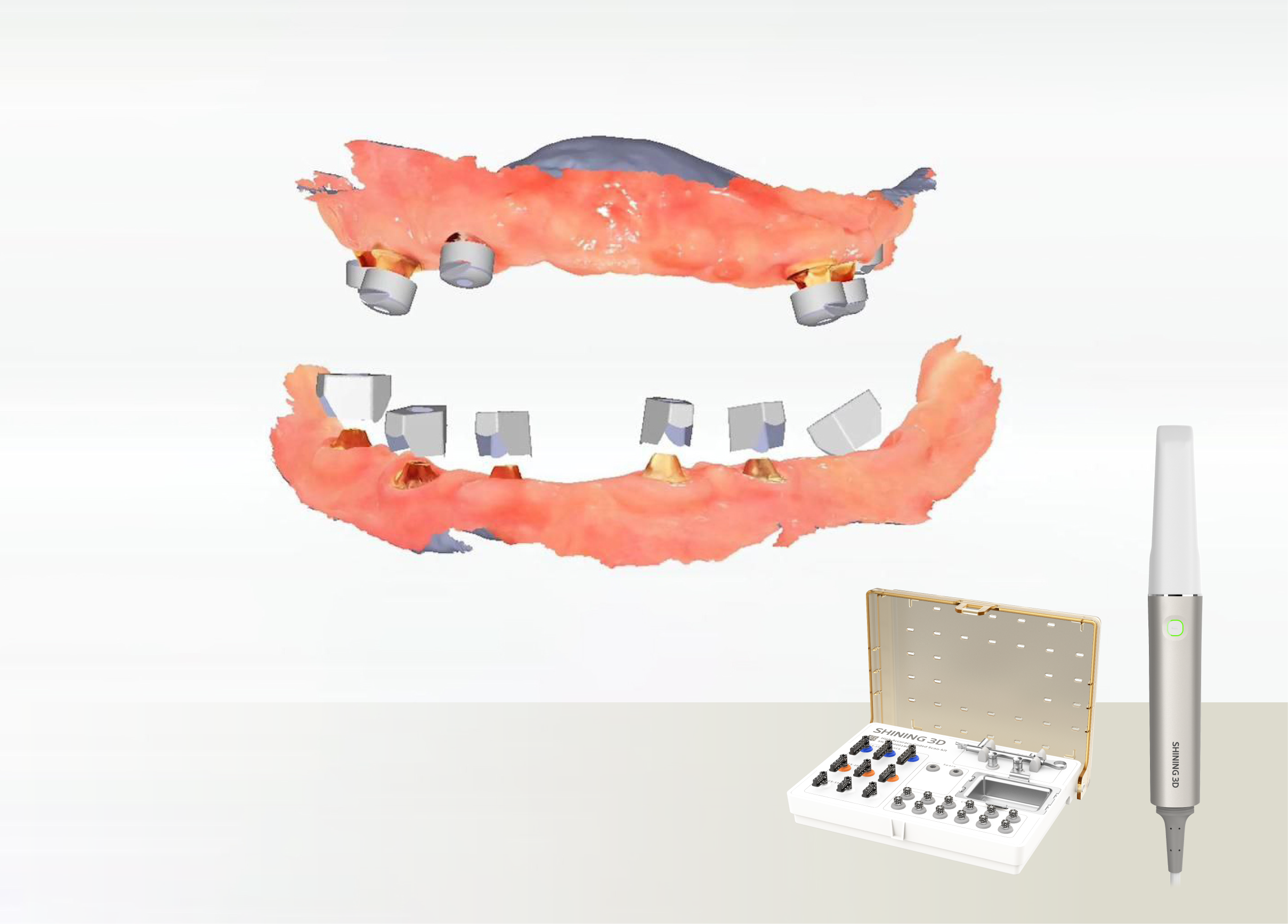 Aoralscan Elite Intraoral Scanner | Shining 3D Dental