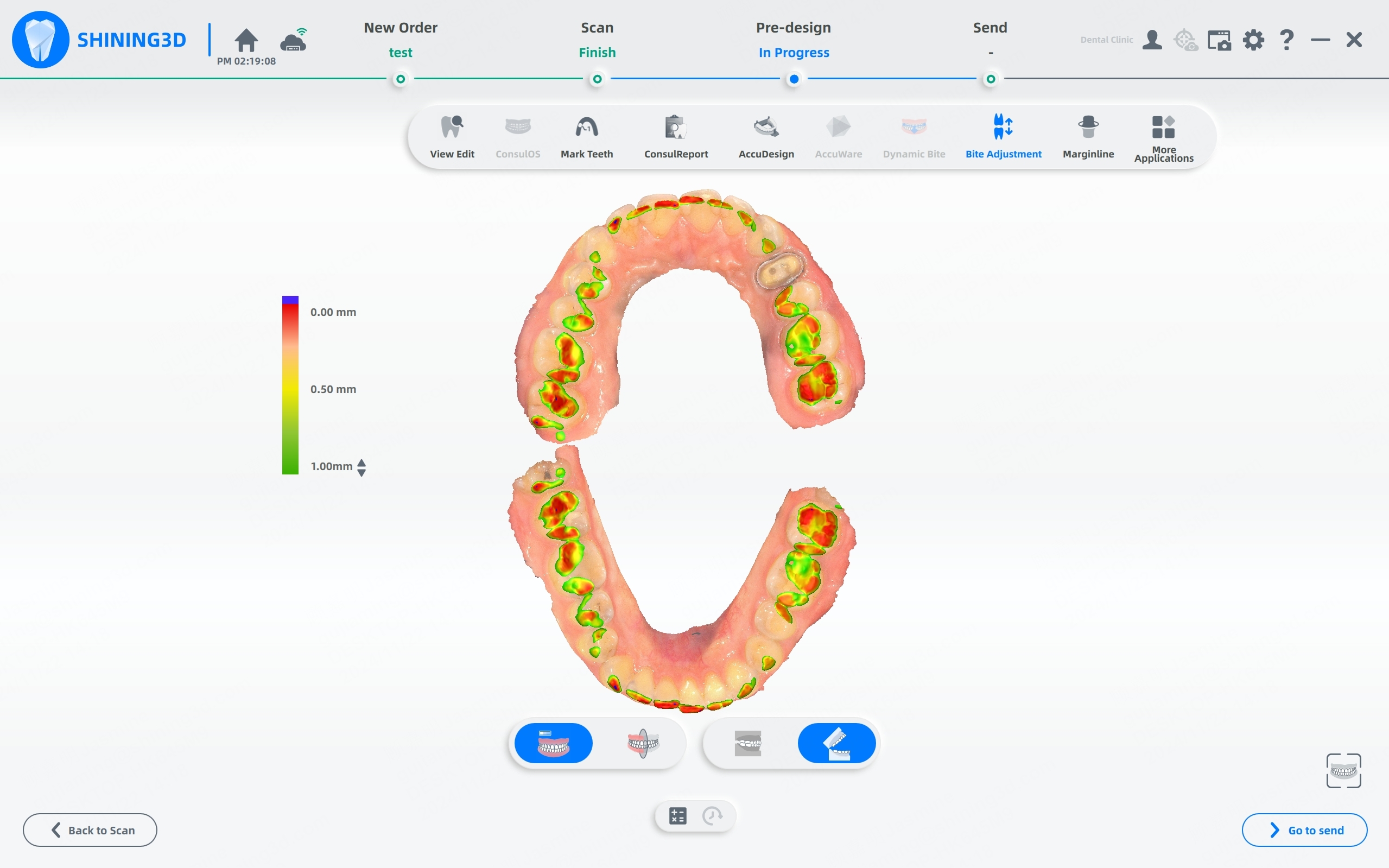 Aoralscan 3 Intraoral Scanner | Shining 3D Dental