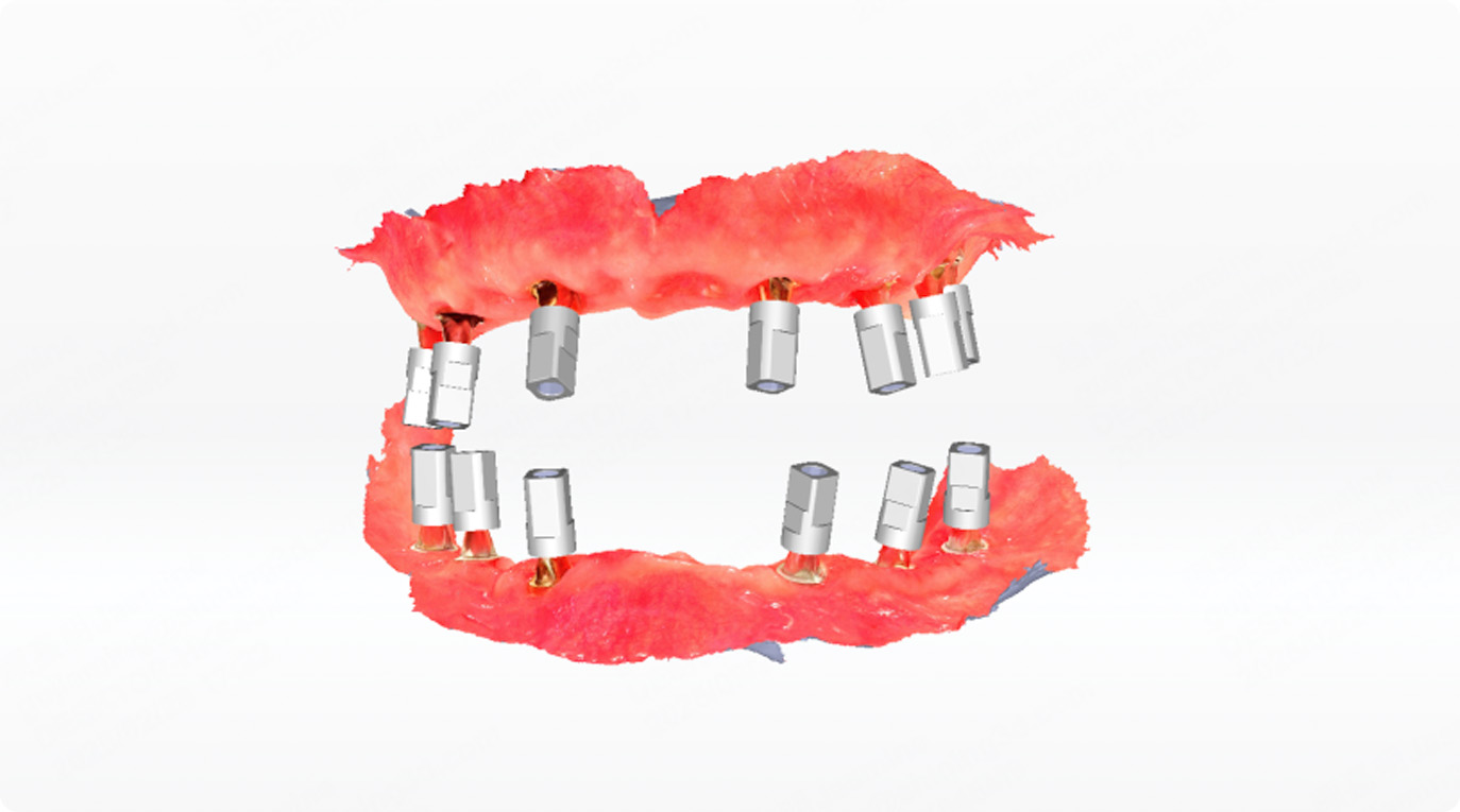 Aoralscan Elite Wireless - www.shining3ddental.com